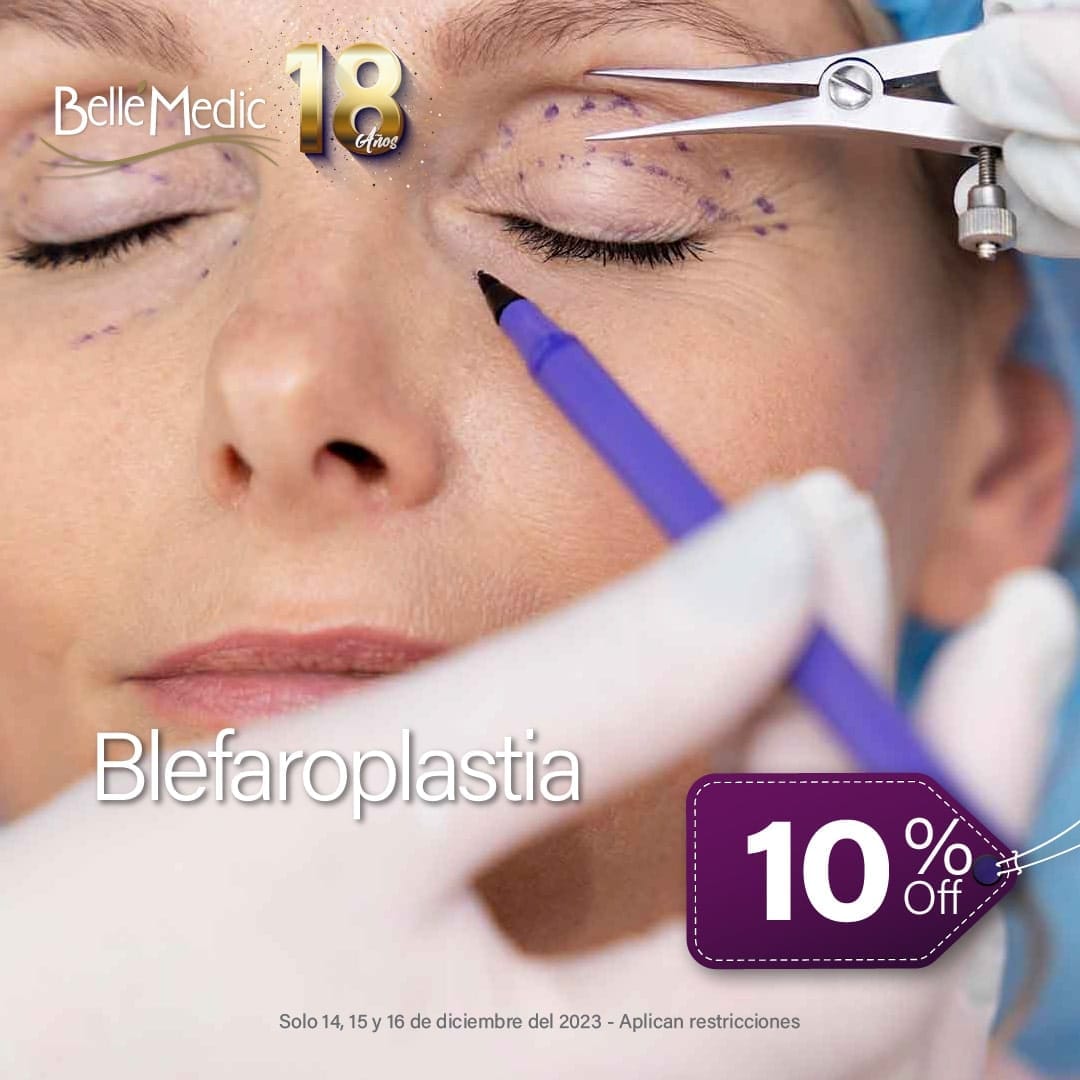 Blefaroplastia - Doctora Grace